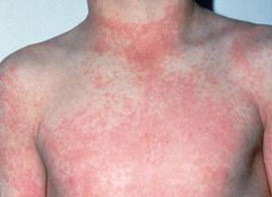 roodvonk - Baby Op Komst